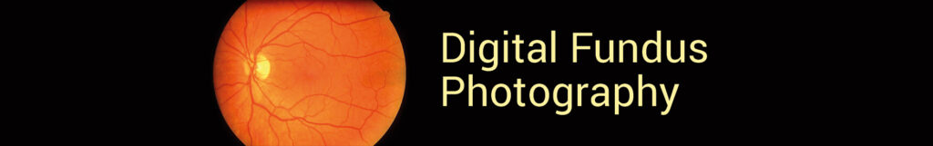 Fundus Photography - Sally French Teeling Opticians Cheadle